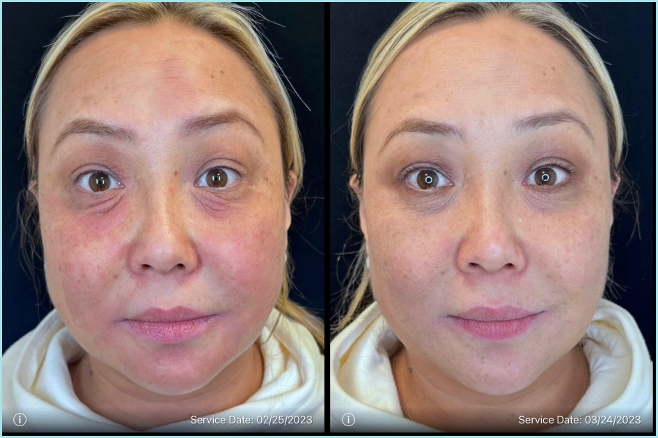 Glacial Skin – Nature Derma™